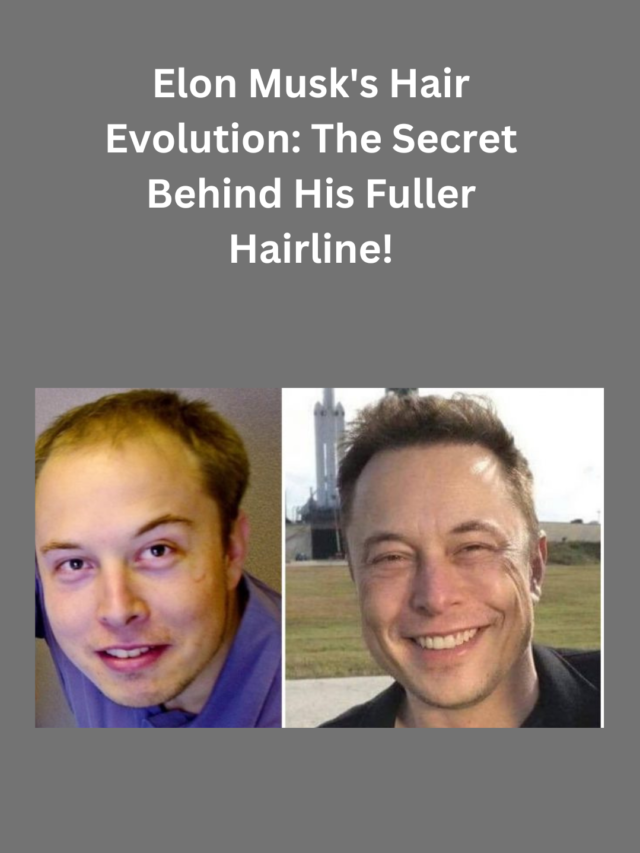 Elon Musk's Hair Transformation: Hair Transplant Secrets Revealed?